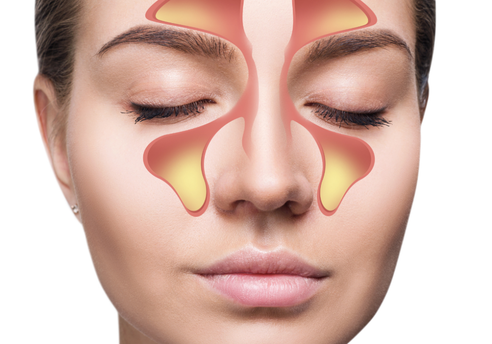 Deviated Septum: Signs That Indicate It's Time to See a Doctor - Orange ...