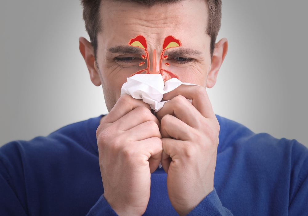 Top Signs You Need a Sinus Specialist - Orange Coast ENT